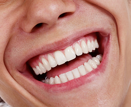 Hobart Dentist Near Me | Salamanca Dental